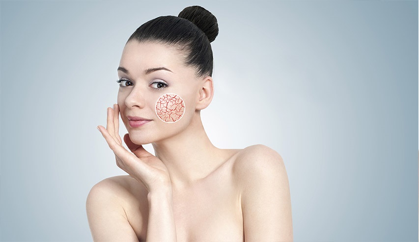 Erythrocouperose | Visage & Cou | Dr. Salma Ben Romdhane